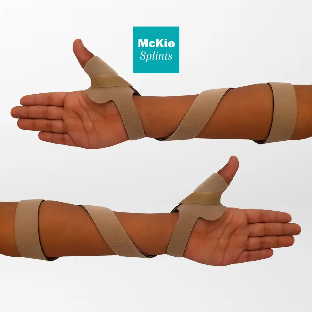 Mckie Splint: Faixa de Supinação para Melhor Aprendizado Motor